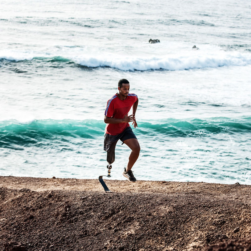 TransFemoral Prosthesis | Vesalius